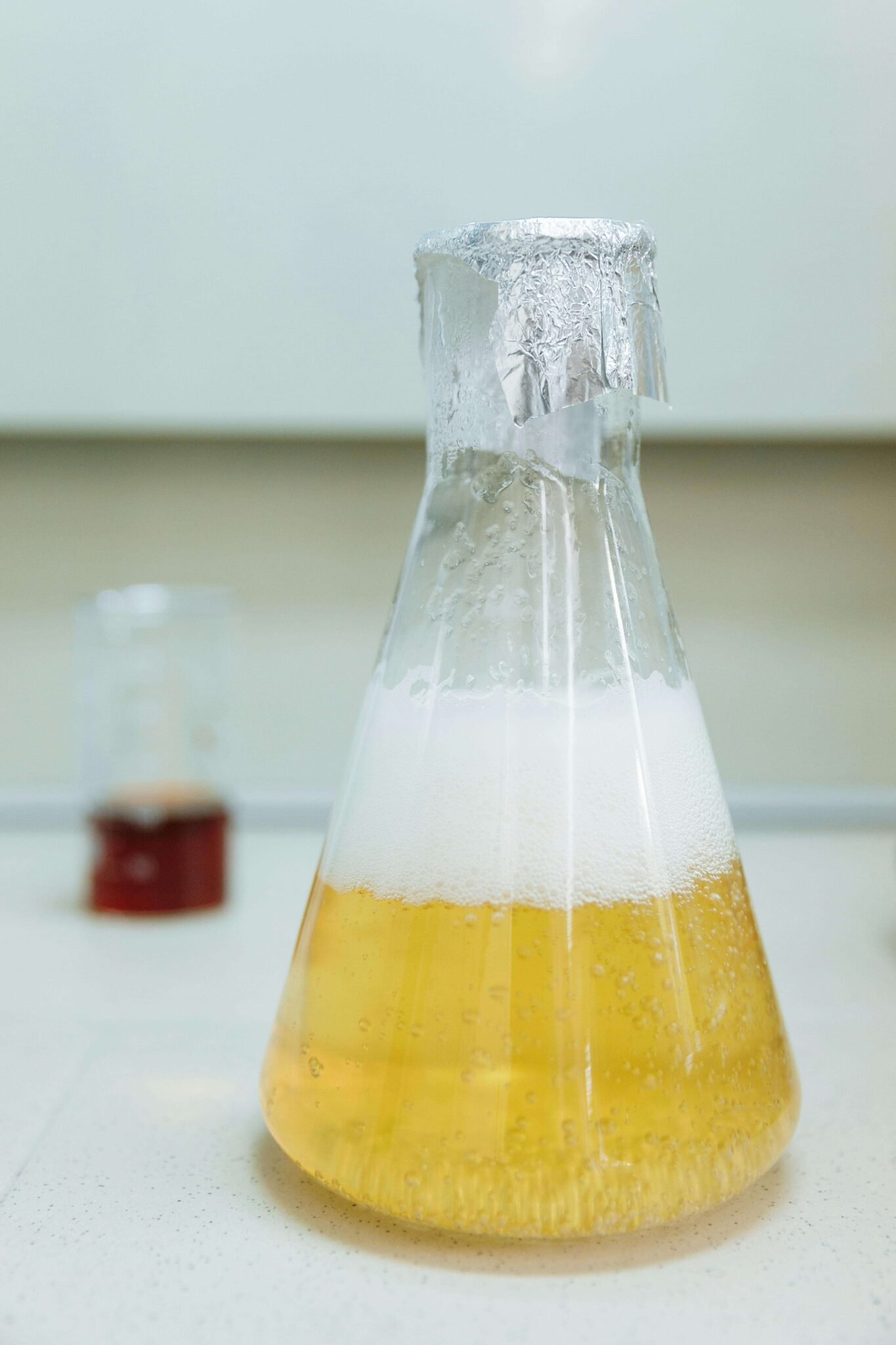 Urine Color Chart: What Your Pee Says About Health & Kidneys?